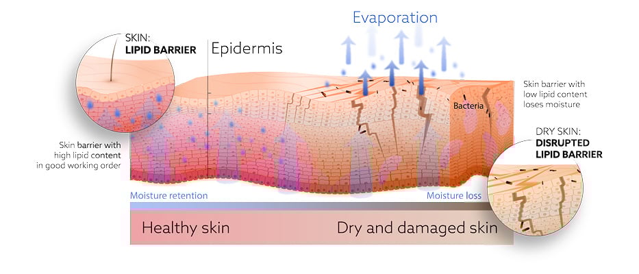 How marine omega-3 phospholipids support skin hydration and elasticity